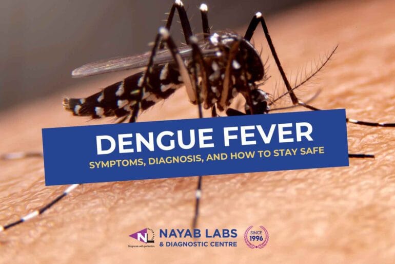 Dengue Fever: Symptoms, Diagnosis, and How to Stay Safe - Nayab Labs ...