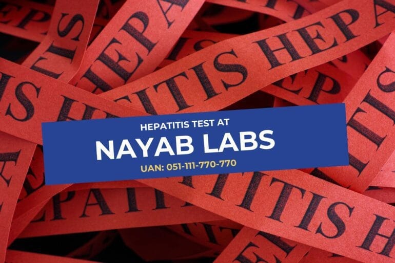 Hepatitis Tests in Islamabad - Nayab Labs and Diagnostic Centre