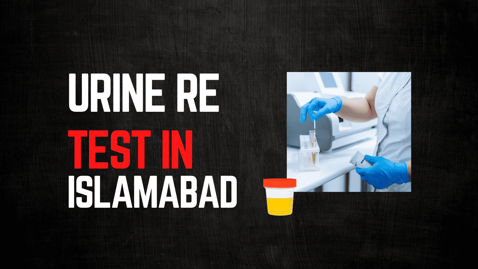 Urine Routine Examination (RE) Test in Islamabad - Nayab Labs and ...