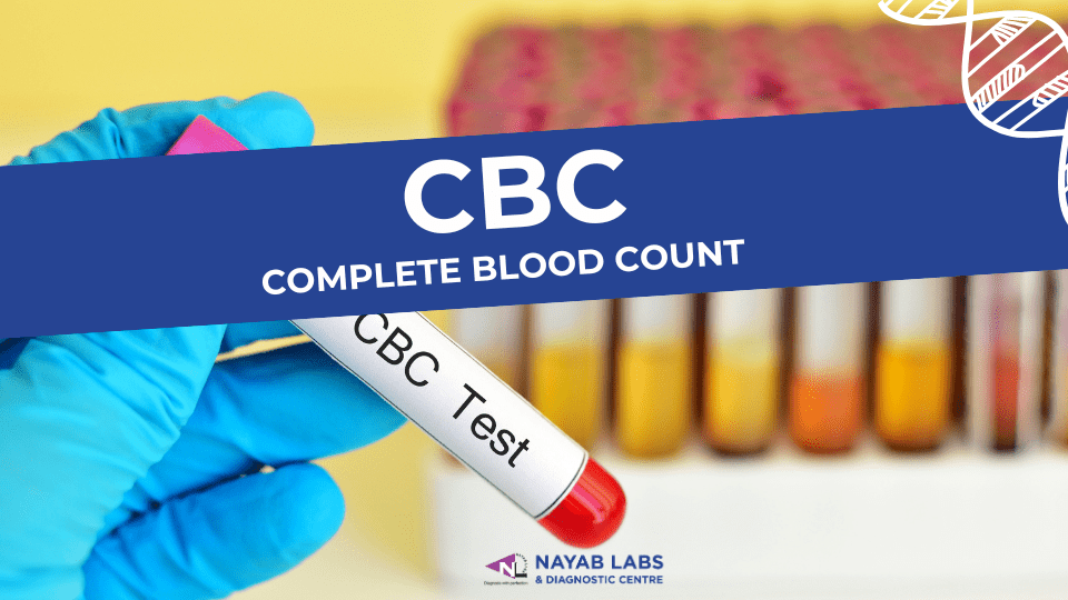 Complete Blood Count (CBC): A Vital Test for Your Health - Nayab Labs ...