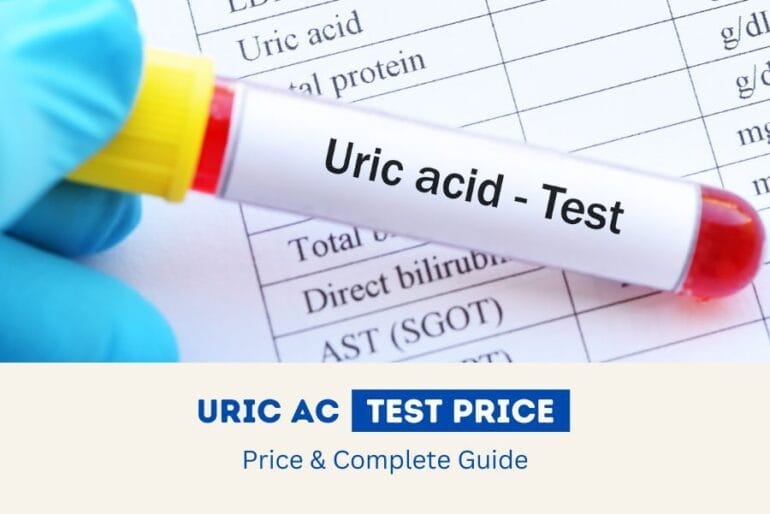 Uric Acid Test in Islamabad – Price & Complete Guide - Nayab Labs and ...