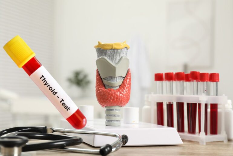 Thyroid Test – Complete Guide, Symptoms, Diagnosis - Nayab Labs and ...