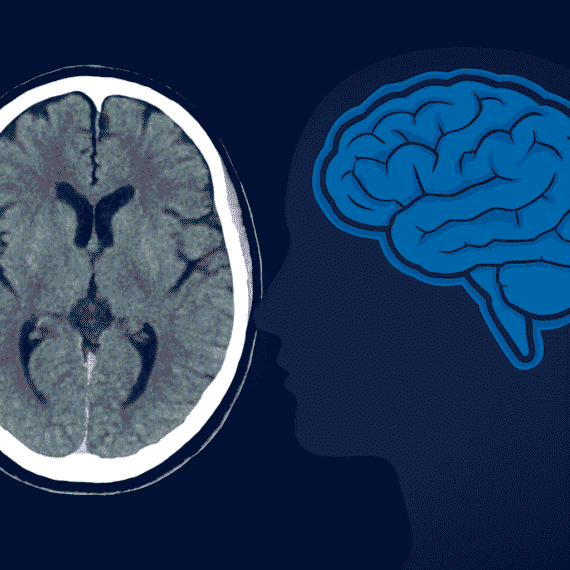 TVS Ultrasound Scan: Procedure, Benefits & Preparation - Nayab Labs and ...