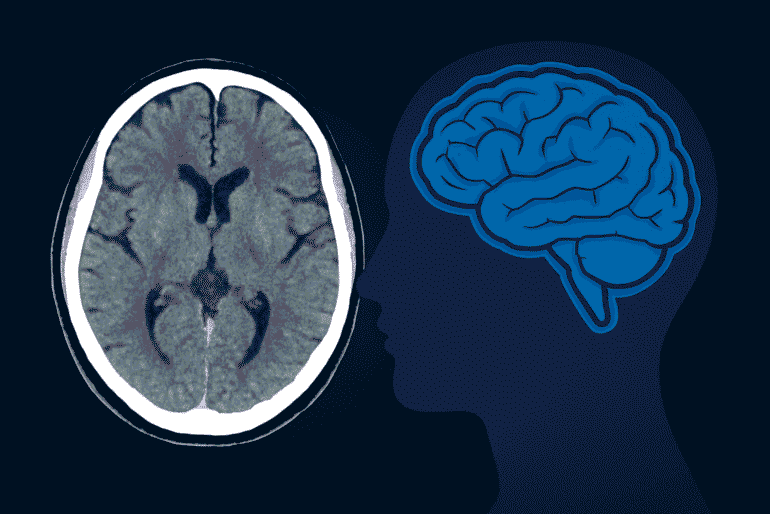 What is a CT Scan? Procedure, Uses and Safety - Nayab Labs and ...